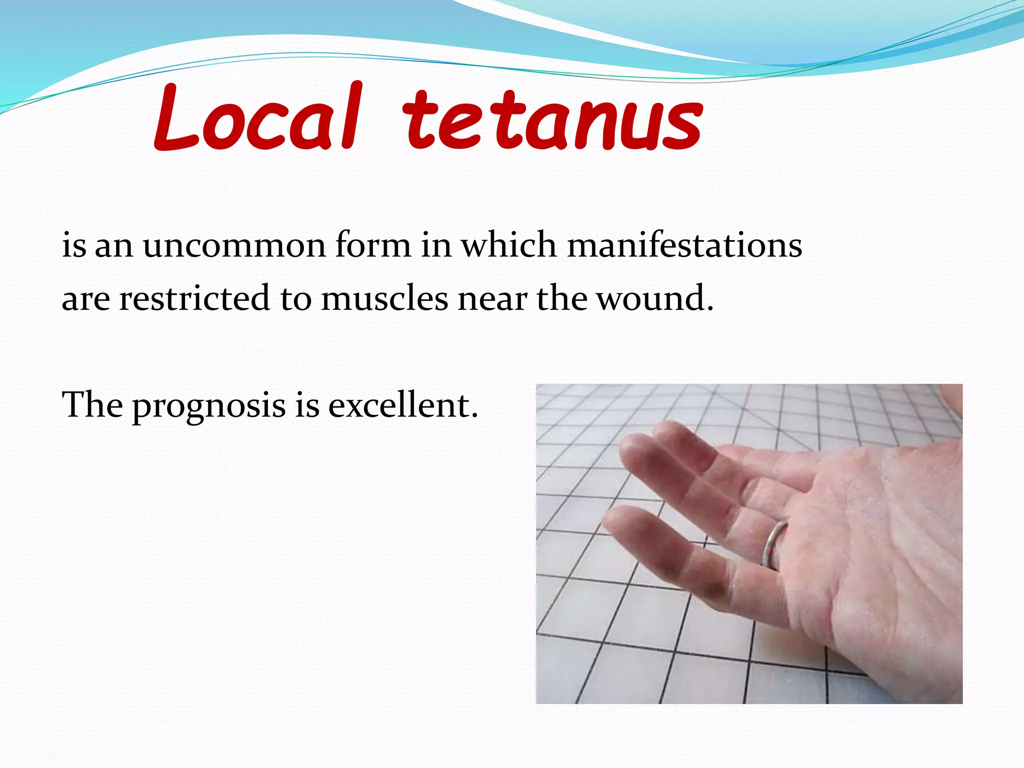 Tetanus | PPTX