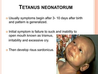 Tetanus Symptoms In Humans
