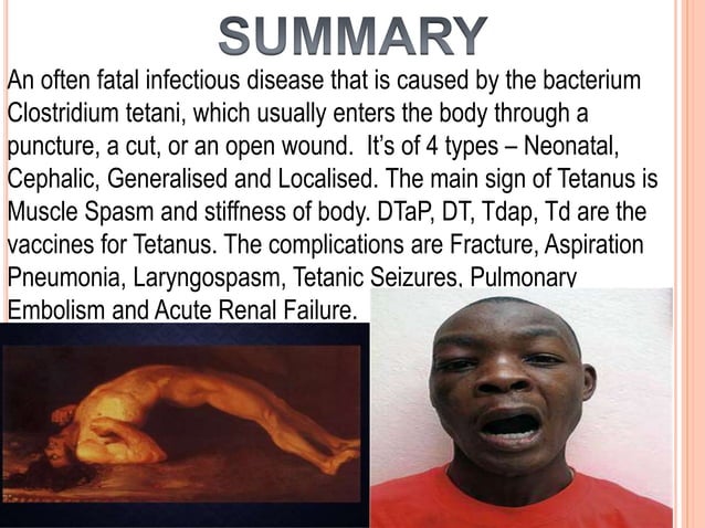 Tetanus also called: lockjaw