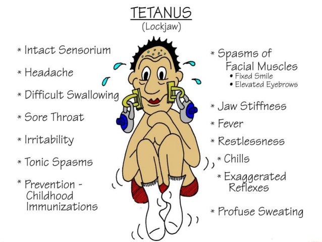 Tetanus also called: lockjaw