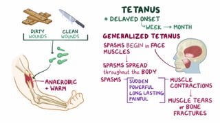 TETANUS information from definition to treatment | PPTX