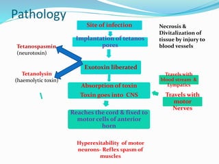 Tetanus | PPT