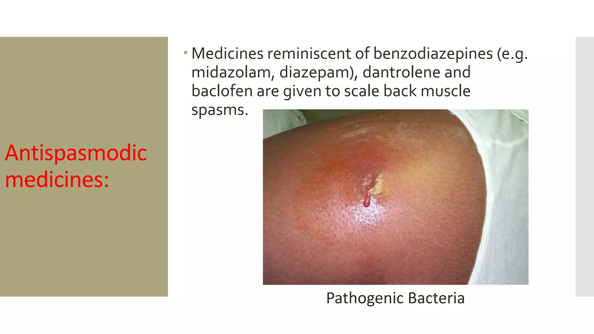 Tetanus |Causes | Signs and symptoms| All aspects - medical discussion ...