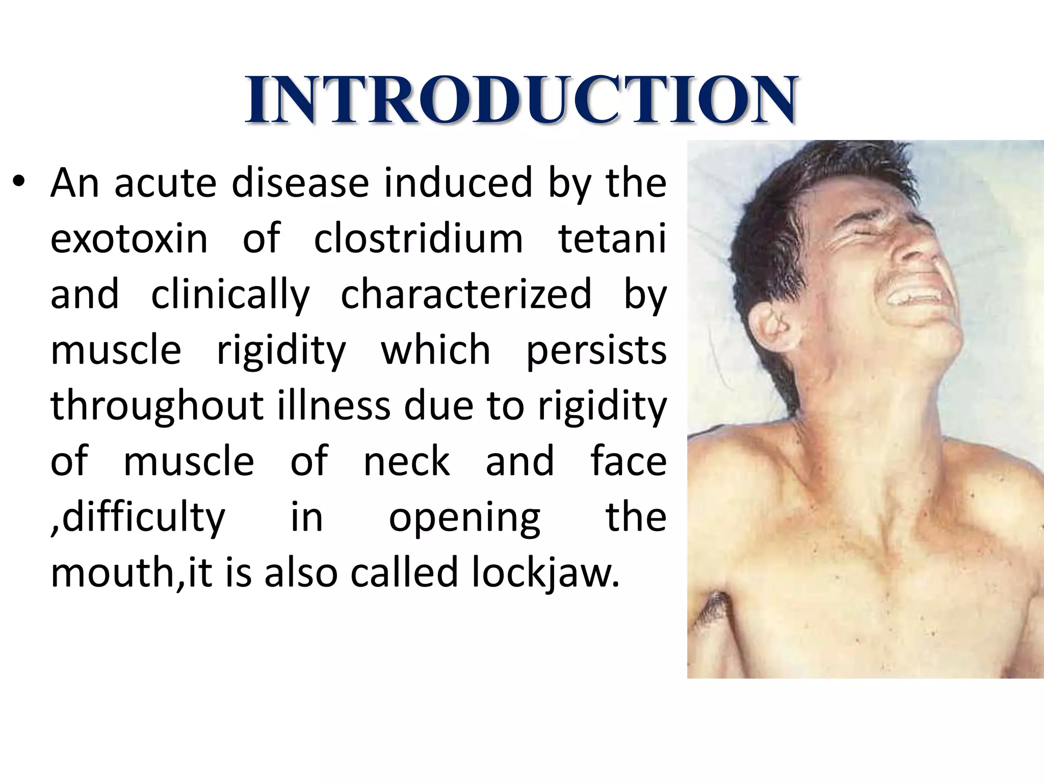 Tetanus | PPTX | Infectious Diseases | Diseases and Conditions
