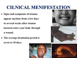 Tetanus | PPTX | Infectious Diseases | Diseases and Conditions