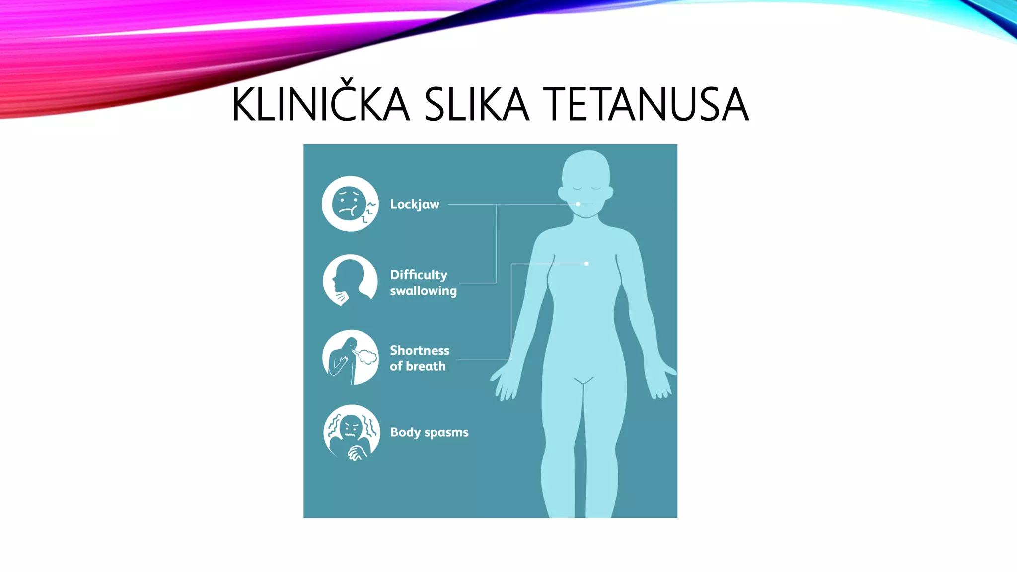 Tetanus - infektologija | PPTX