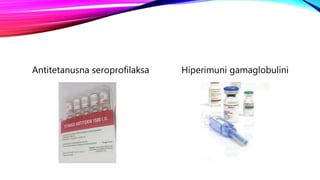 Tetanus - infektologija | PPTX