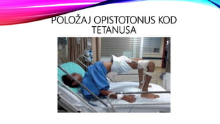 Tetanus - infektologija | PPTX