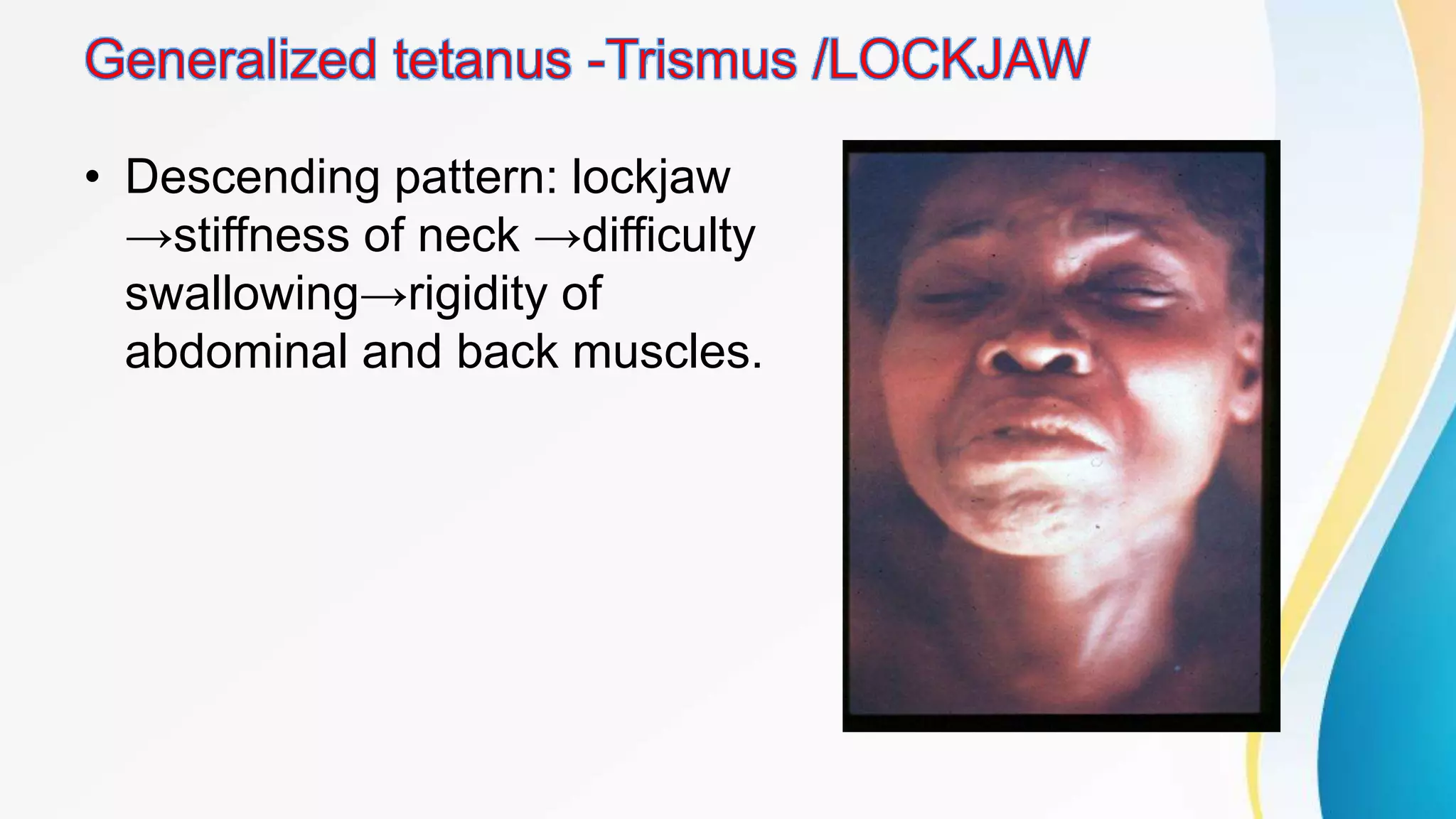 Tetanus | PPTX