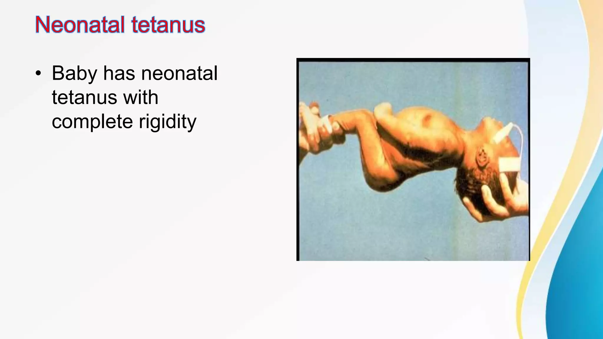 Tetanus | PPTX