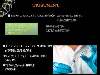 Tetanus | PDF