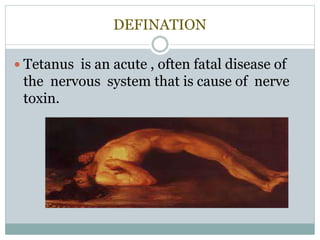 tetanus.pptx