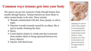 Tetanus.pptx