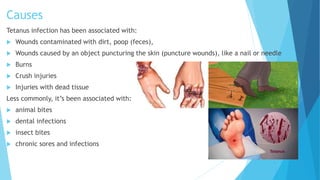 Tetanus.pptx