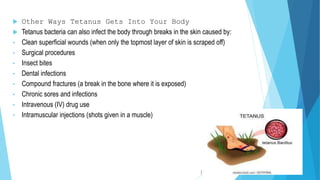 Tetanus.pptx