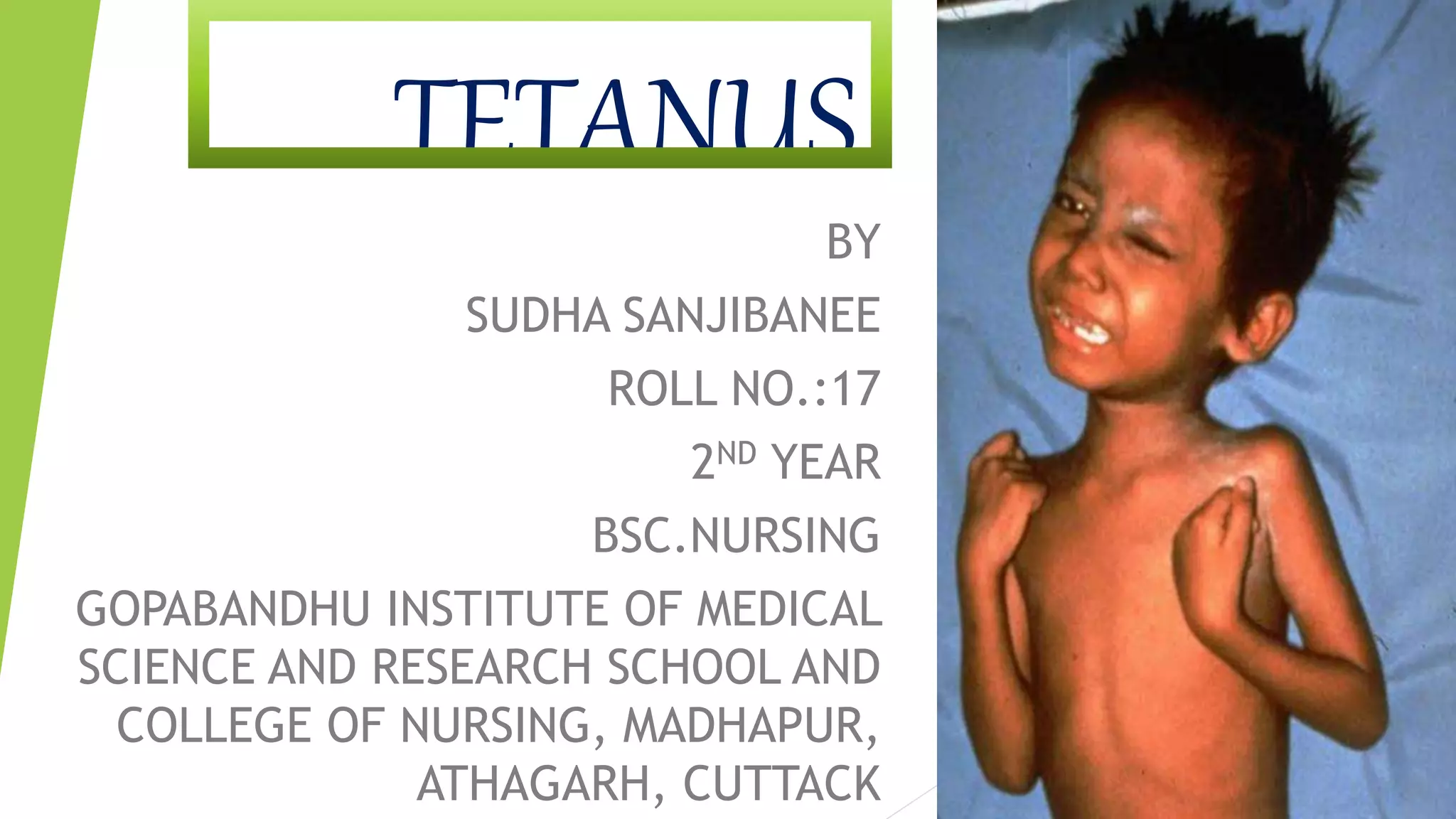 TETANUS | PPT
