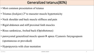 Tetanus.pptx