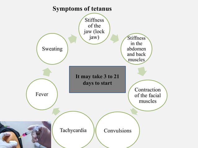Tetanus.ppt