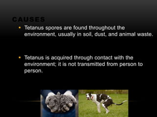 Tetanus.ppt
