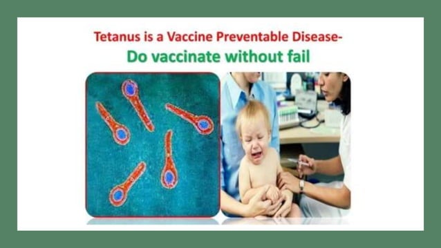 Tetanus.pptx