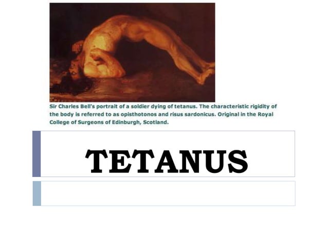 Tetanus Adult health nursing 3rd Semester | PPT