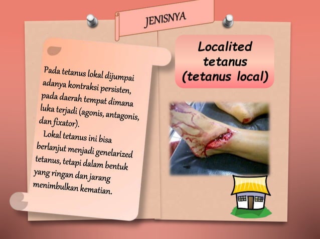 persentasi kesehatan materi mengenai tetanus.pptx