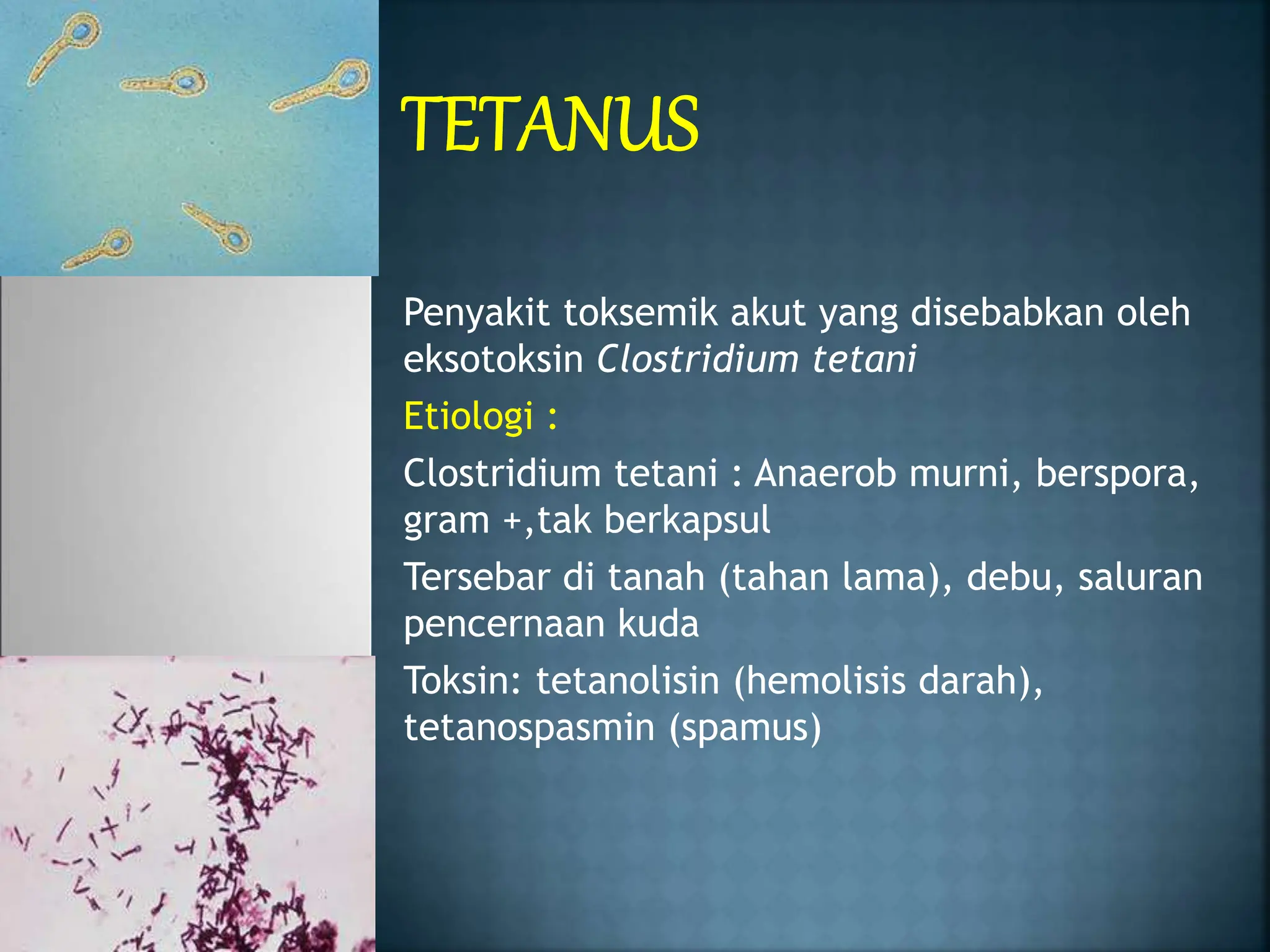 tetanus definisi dan penatalaksanaannya.ppt