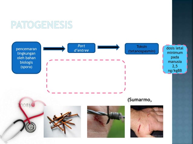 tetanus definisi dan penatalaksanaannya.ppt