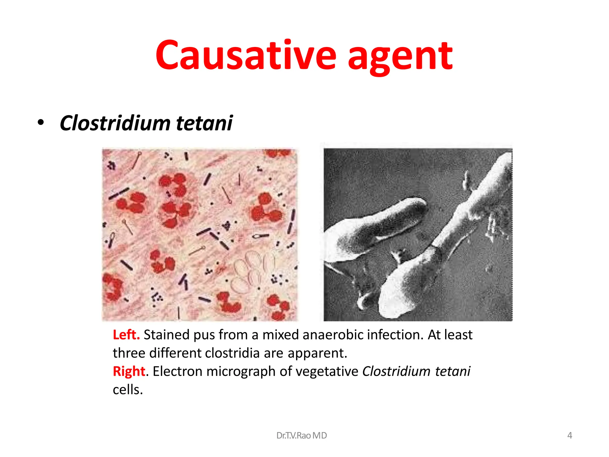 tetanus.pptx, introduction, pathophysiology | PPTX
