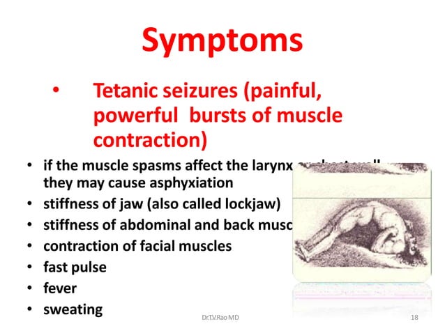 tetanus.pptx, introduction, pathophysiology | PPTX | Infectious Diseases | Diseases and Conditions