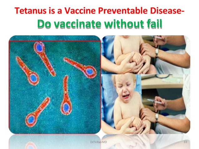 tetanus.pptx, introduction, pathophysiology | PPTX | Infectious Diseases | Diseases and Conditions