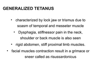 tetanus(oral medicine and oral pathology) | PPT