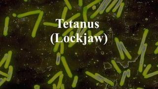 Tetanus Powerpoint Presentation.....pptx
