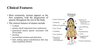 Tetanus Powerpoint Presentation.....pptx