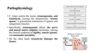 Tetanus Powerpoint Presentation.....pptx