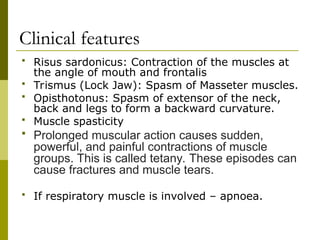Tetanus ,prophylaxis amd it's management | PPT