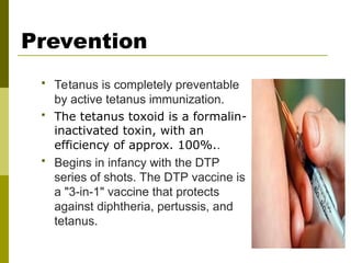 Tetanus ,prophylaxis amd it's management | PPT