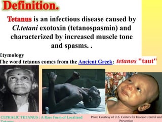 kind of (clostridium tetani )Tetanus.ppt