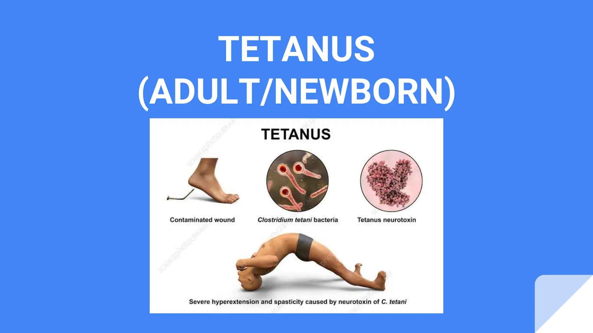 TETANUS-ADULT_NEWBORN-2 2.pptx