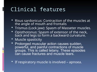 Tetanus - Mymensingh Medi+. .pptx