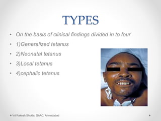 Tetanus | PPT