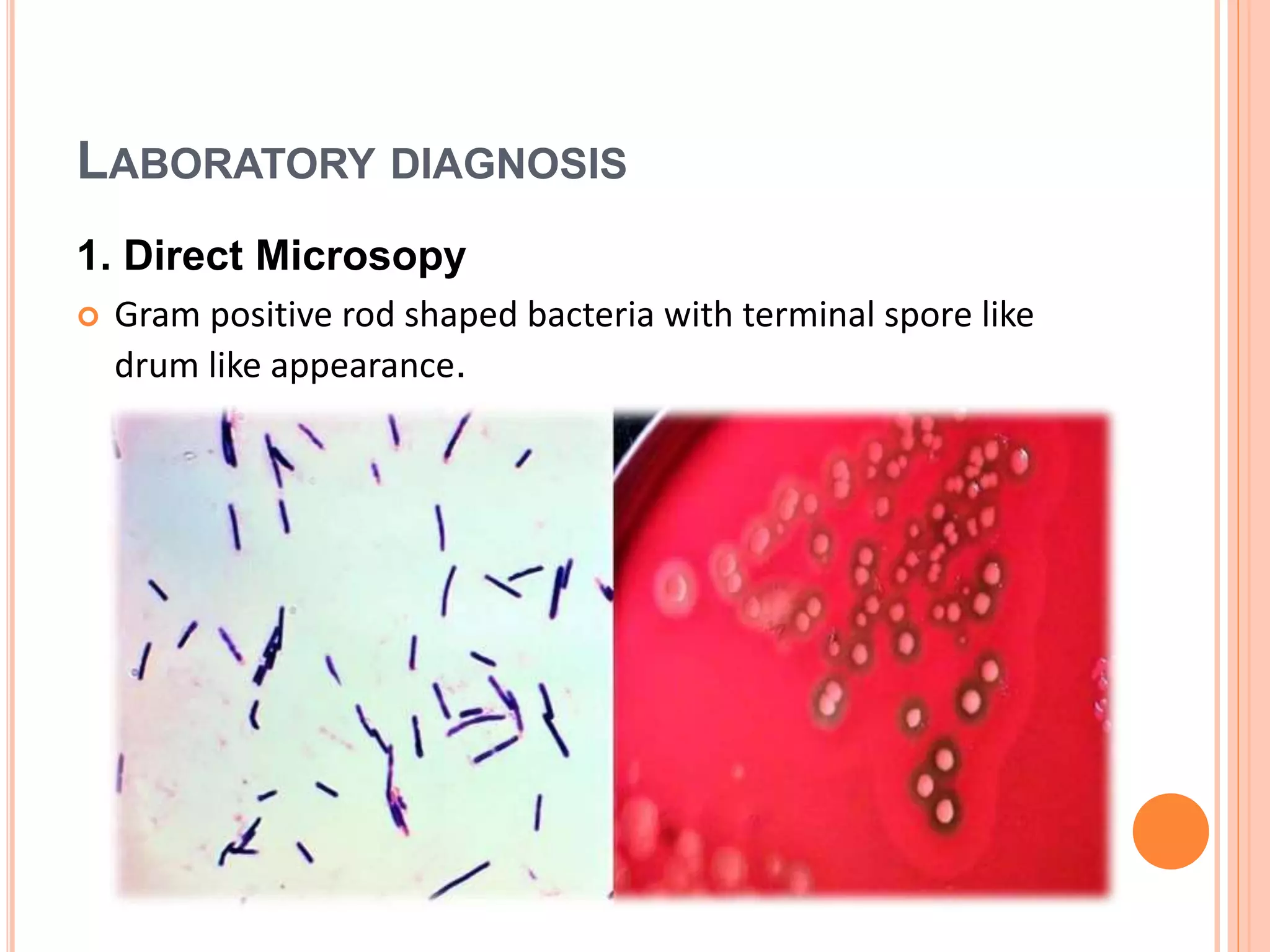 Tetanus and botulism PG | PPTX