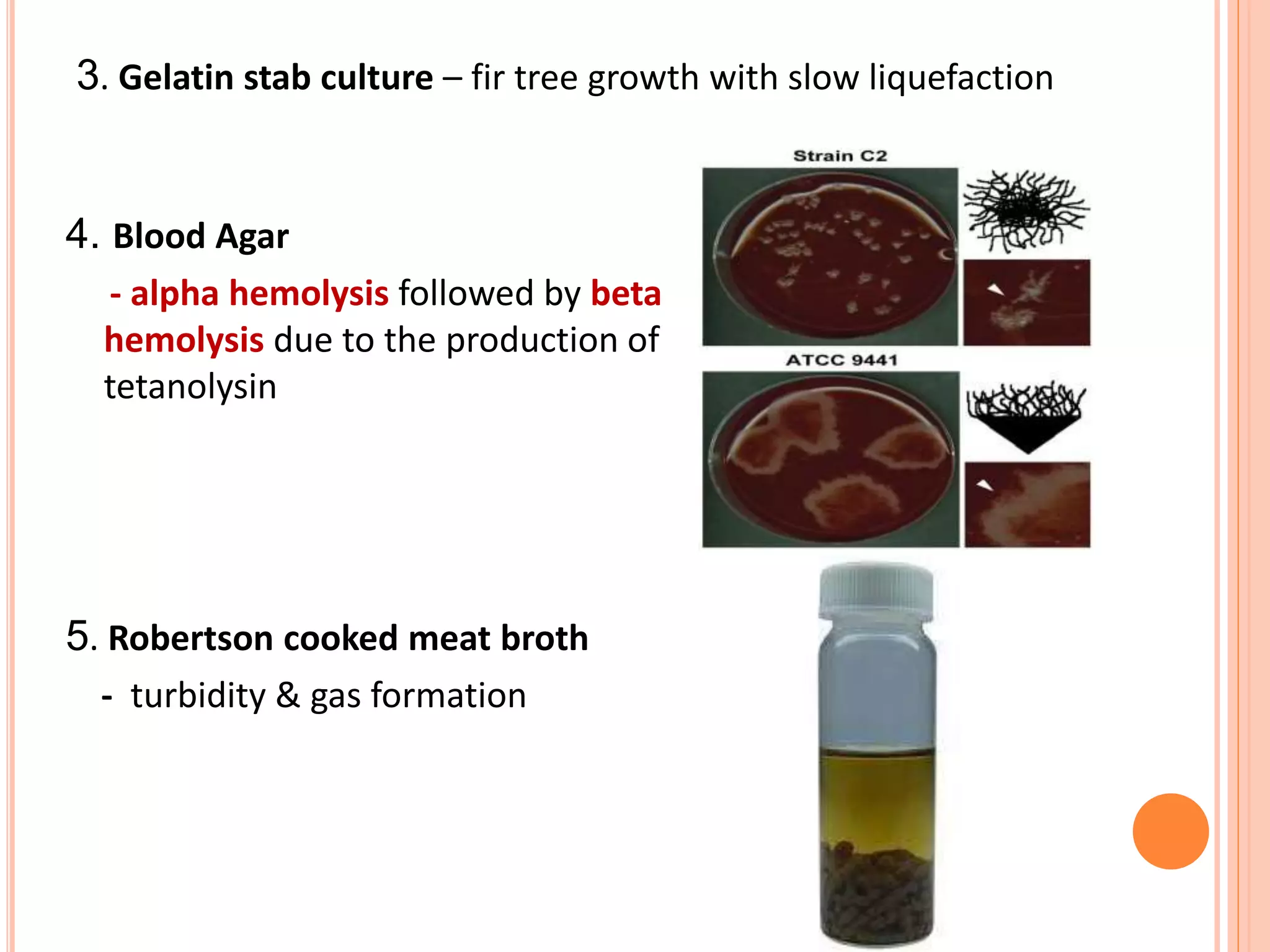 Tetanus and botulism PG | PPTX