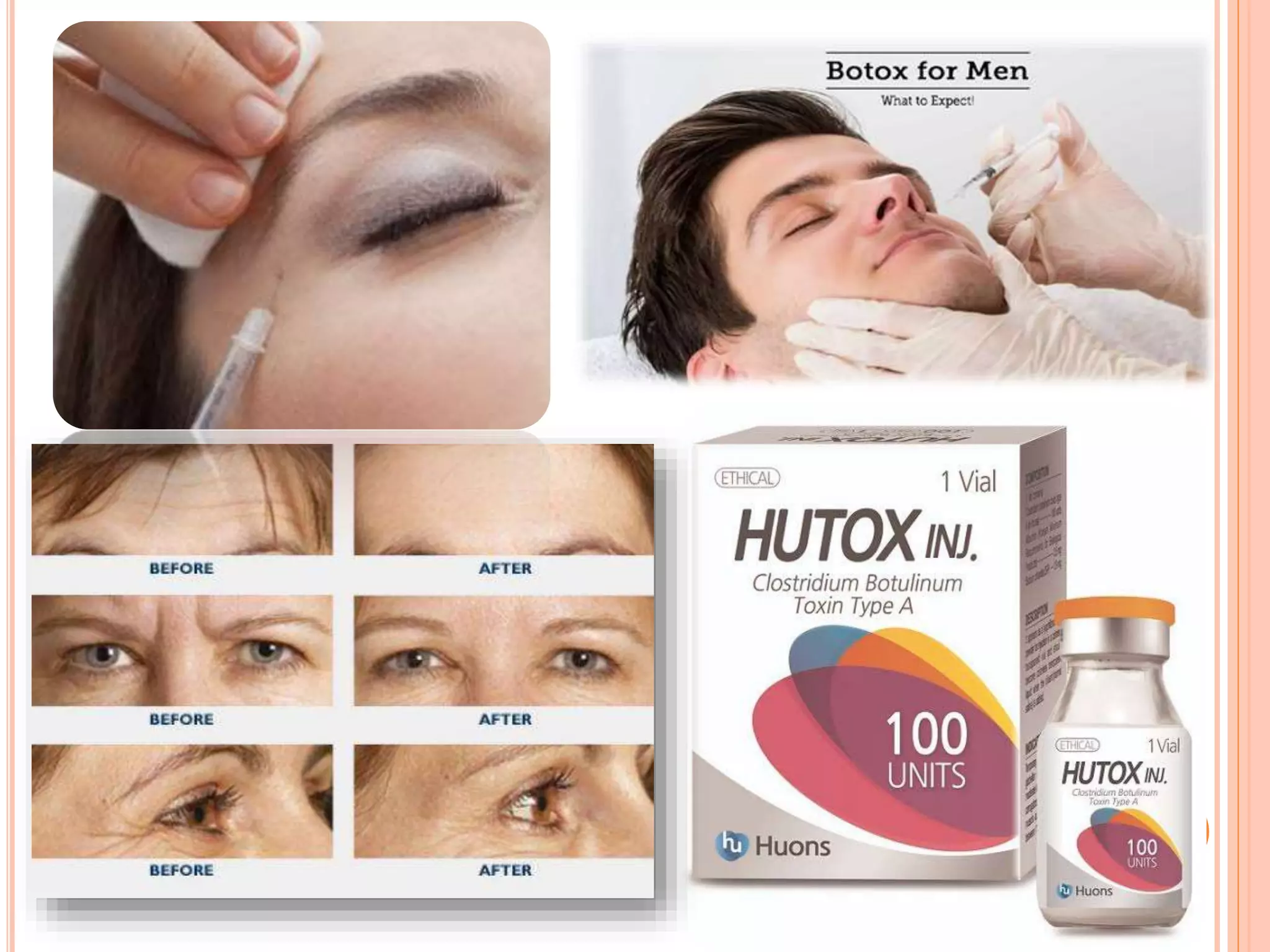 Tetanus and botulism PG | PPTX