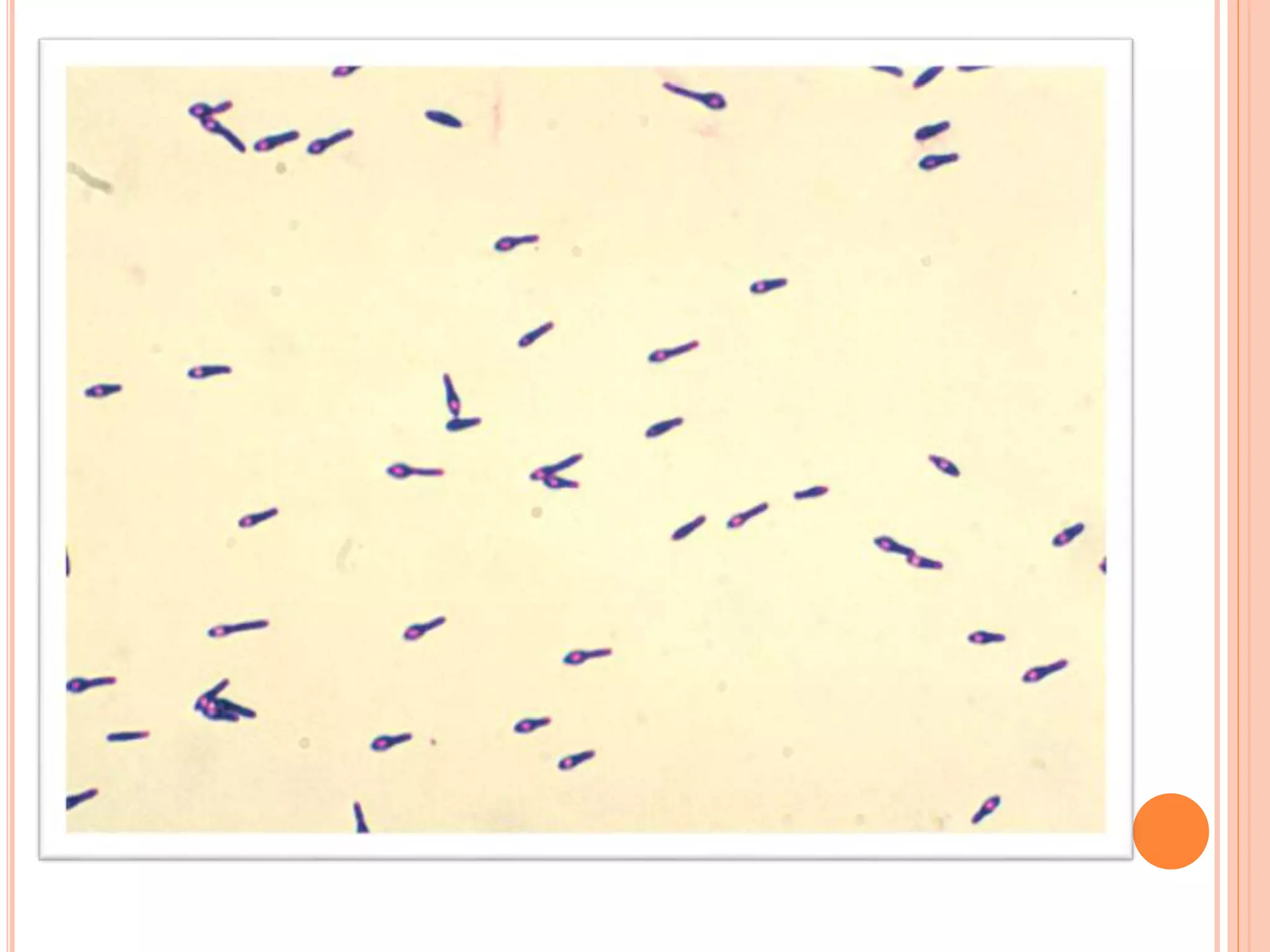 Tetanus And Botulism Pg Ppt