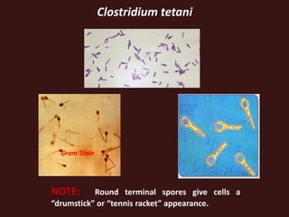 Tetanus -Basics | PPTX