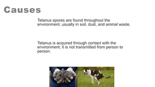 Tetanus | PPTX
