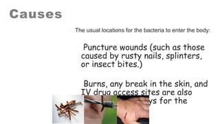 Tetanus | PPTX