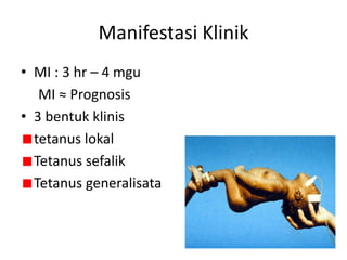 Tetanus dan gas gangren | PPTX