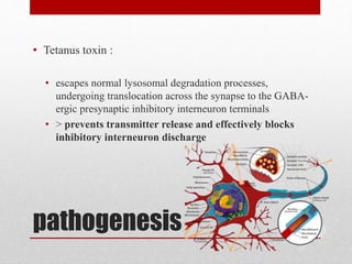 Tetanus discussion | PPTX